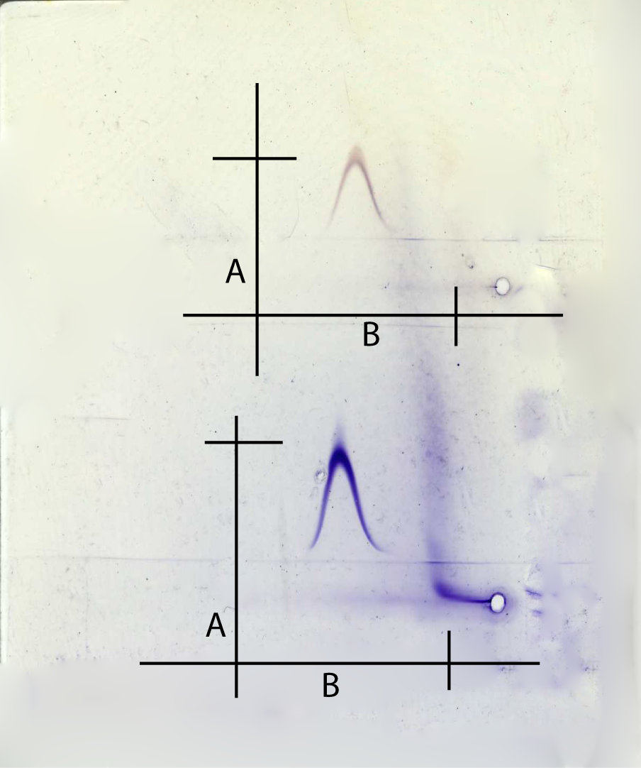 Von Willebrand Factor: Multimers